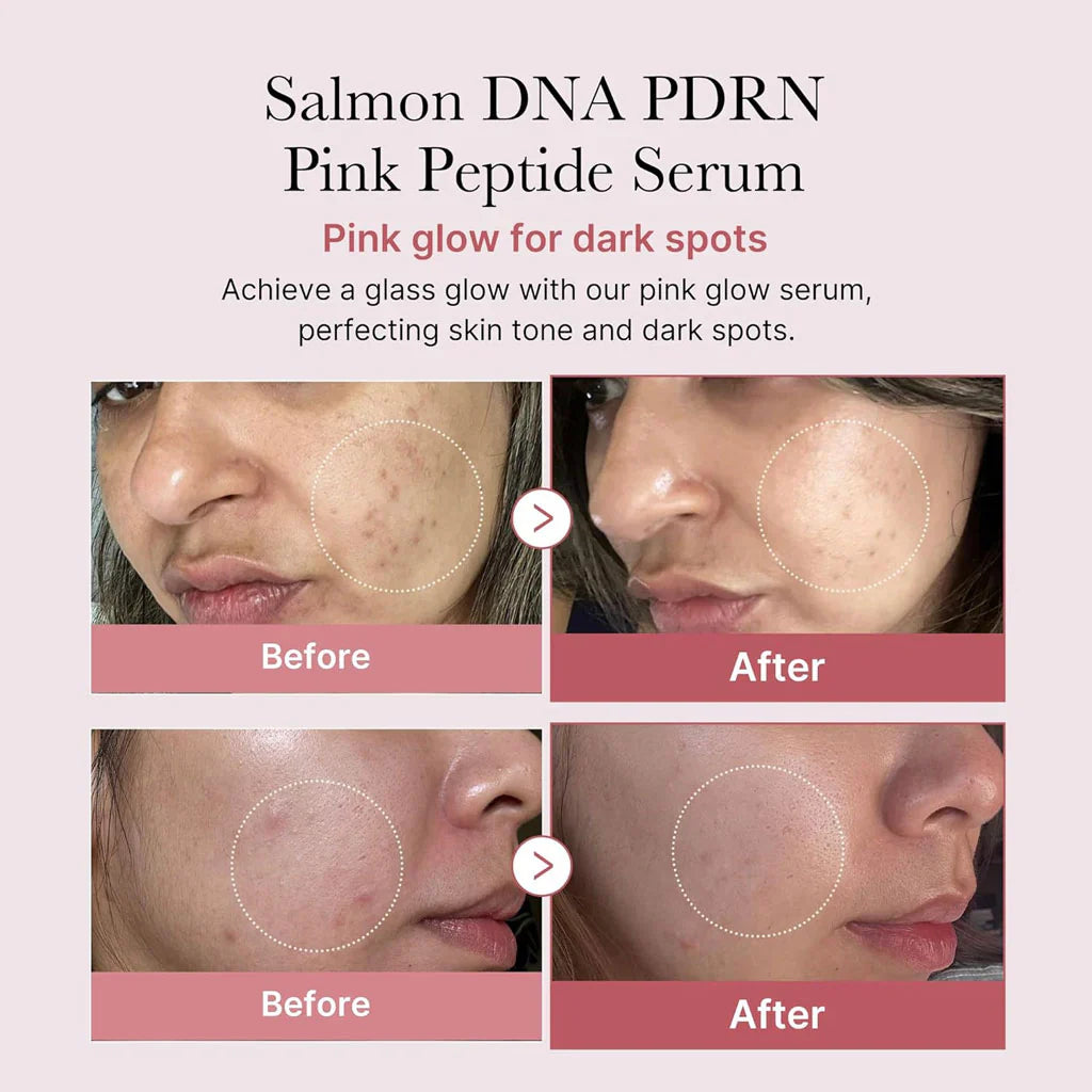 Unlock the PDRN Pink Cream Benefits for Radiant Glass-Like Skin